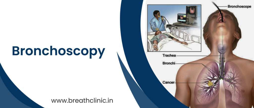 Bronchoscopy Test in Jaipur, Rajasthan | Dr. Pankaj Gulati